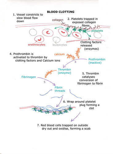 Clotting and heart disease | Teaching Resources