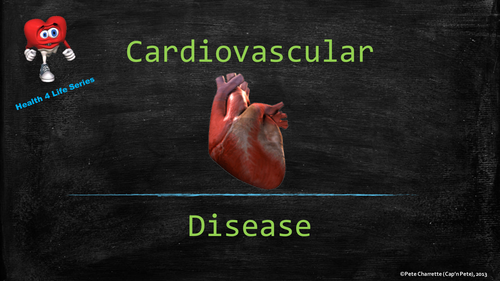 Cardiovascular Disease- PowerPoint Presentation | Teaching Resources Cardiovascular Disease- PowerPoint Presentation | Teaching Resources