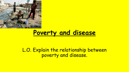 Geography of disease | Teaching Resources