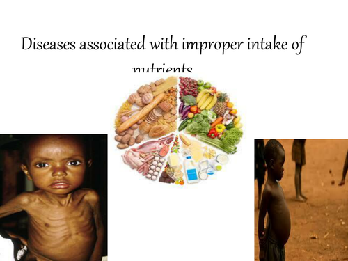 Deficiency diseases | Teaching Resources