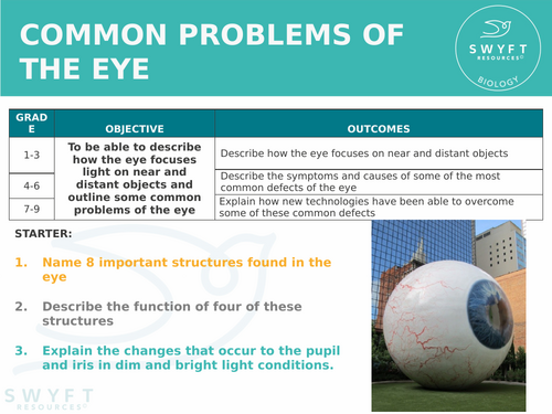 NEW AQA GCSE Biology (2016) - Common problems of the eye HT | Teaching ...