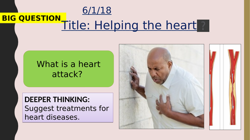AQA new specification-Helping the heart-B4.4 | Teaching Resources