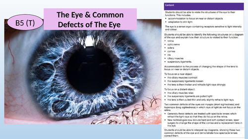 AQA GCSE 9-1 The Eye and Problems/Defects of the Eye (2-3 lessons ...