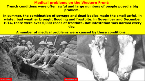 World War One: Injuries and Treatment | Teaching Resources