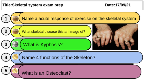 Skeleton Wars! Skeletal system revision lesson | Teaching Resources