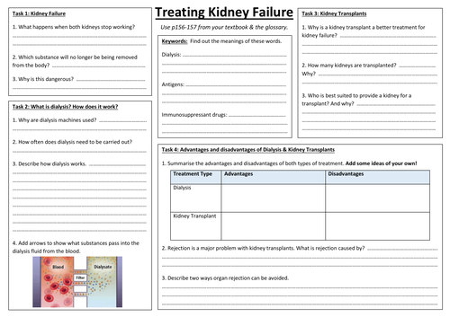 SB7h - Kidney Failure & Dialysis A3 sheet (Edexcel Single Biology GCSE ...