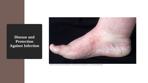 Disease and Protection Against Infection | Teaching Resources