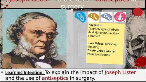 GCSE History – Medicine - Joseph Lister | Teaching Resources