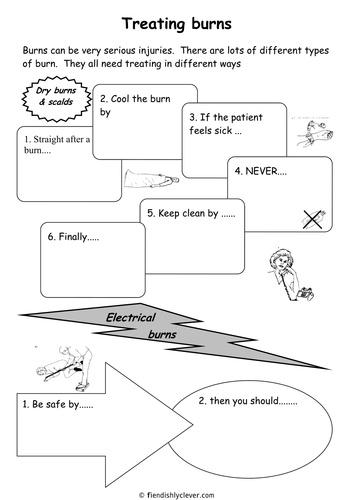 Treating a Burn | Teaching Resources