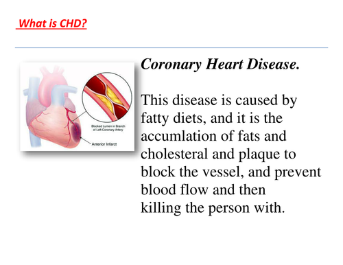 What is CHD? | Teaching Resources