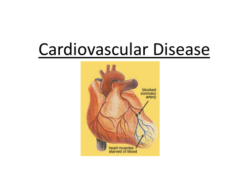 cardiovascular disease powerpoint | Teaching Resources