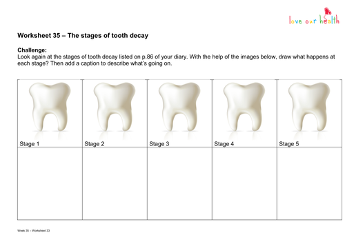 The stages of tooth decay by GEMorshdy - Teaching Resources - Tes