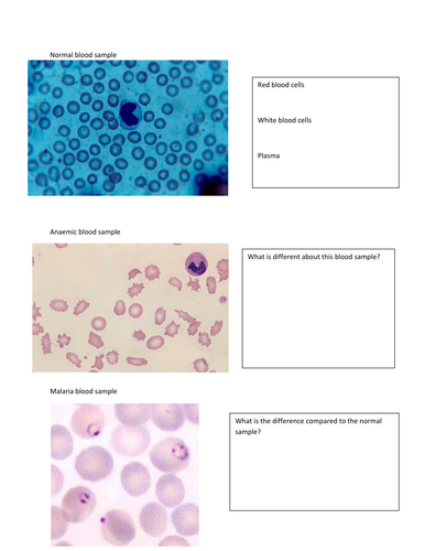 Comparing blood slides | Teaching Resources